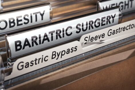 GPs told they can decline private bariatric surgery aftercare requests ...