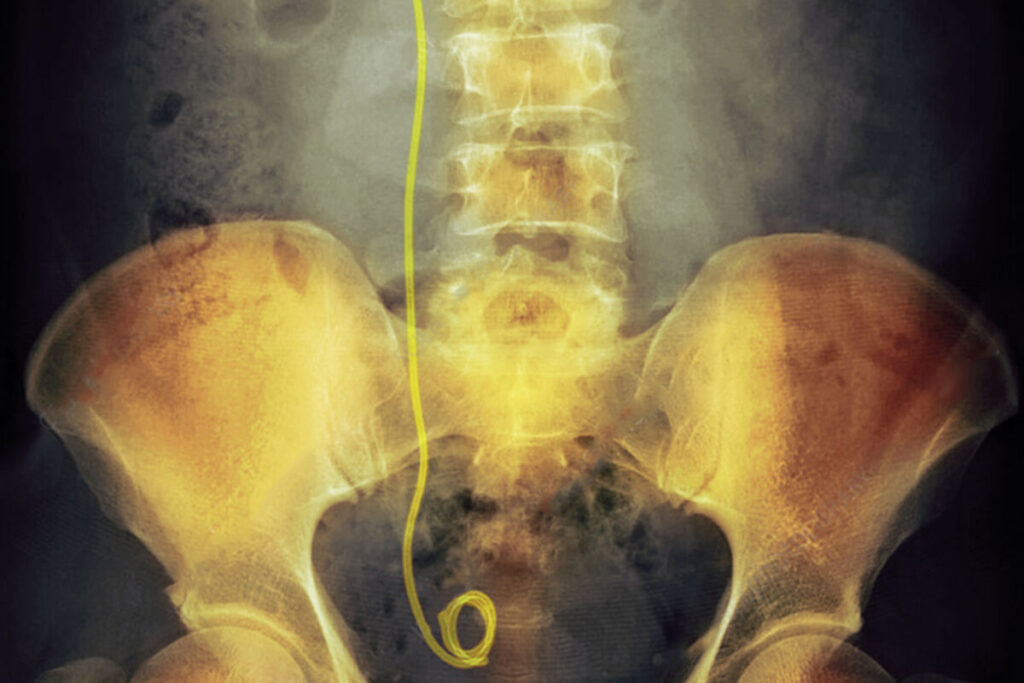 Rational referrals: Urology - Pulse Today