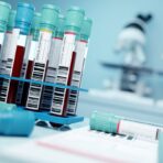 The new NOGG guidelines for osteoporosis - Pulse Today