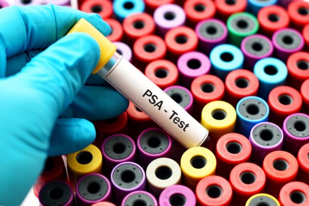 Targeted prostate cancer screening programme to be rolled out next year ...